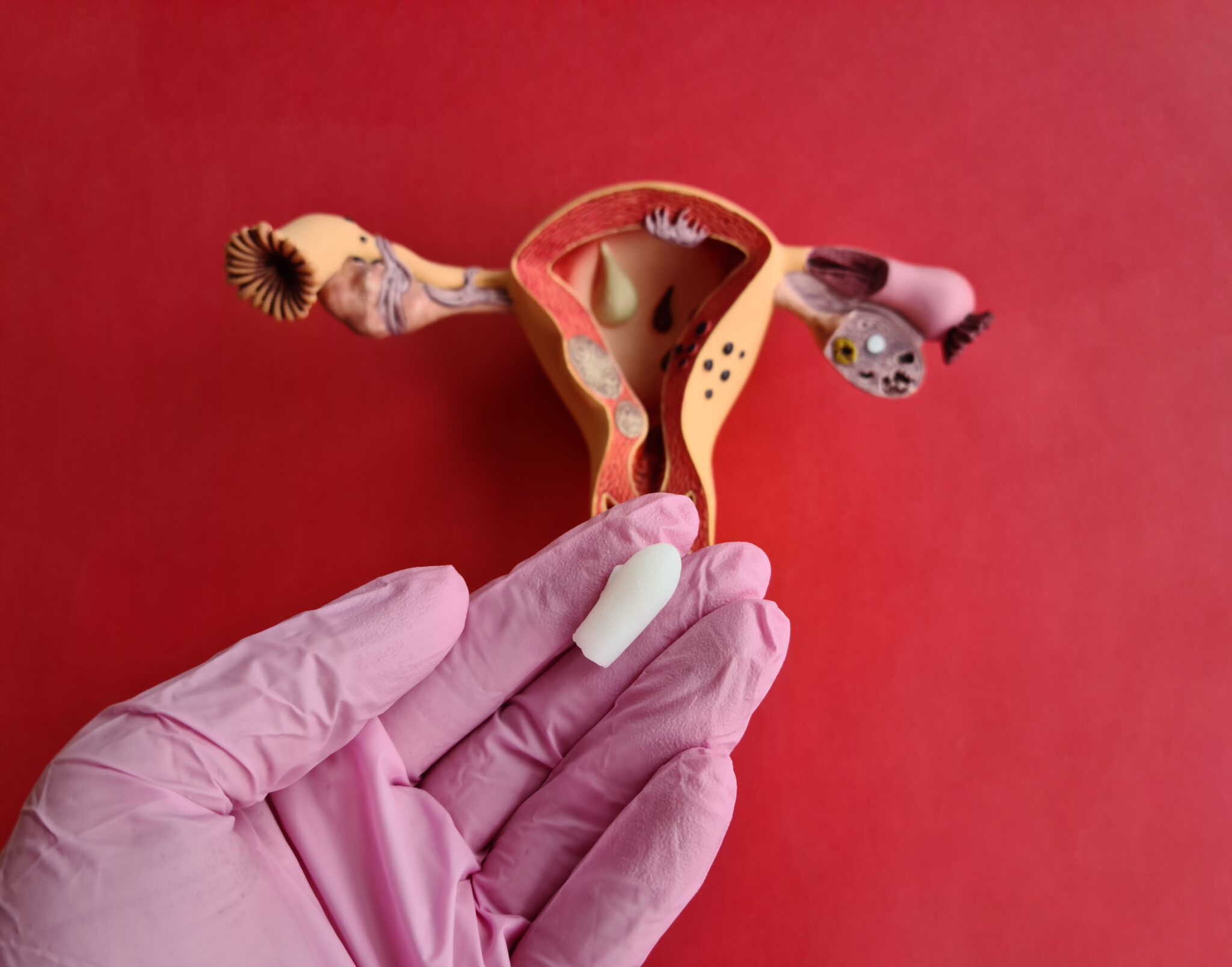 Cannabis Suppositories? A New Frontier for Wellness Brands – Cannabis ...